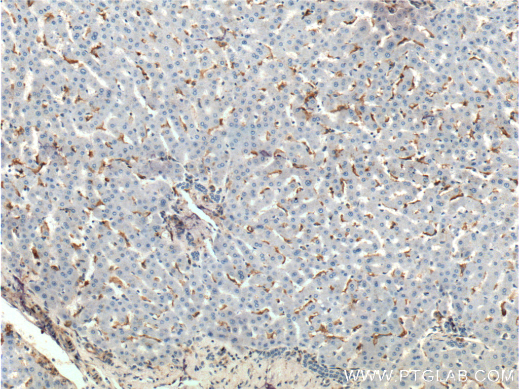 CD16 Antibody 16559-1-AP | Proteintech