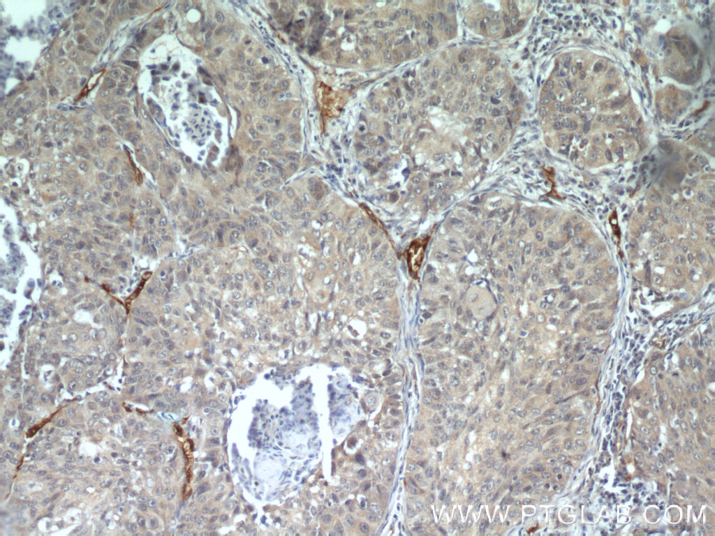 TEM1 Antibody 18160-1-AP | Proteintech
