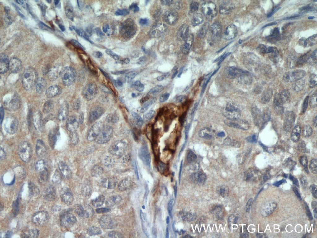 TEM1 Antibody 18160-1-AP | Proteintech