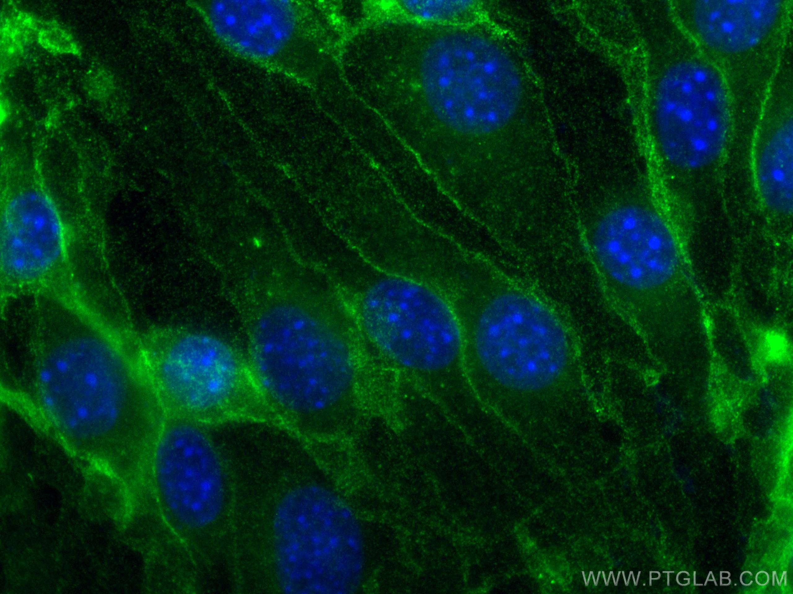 CD31 Antibody 65058-1-Ig | Proteintech