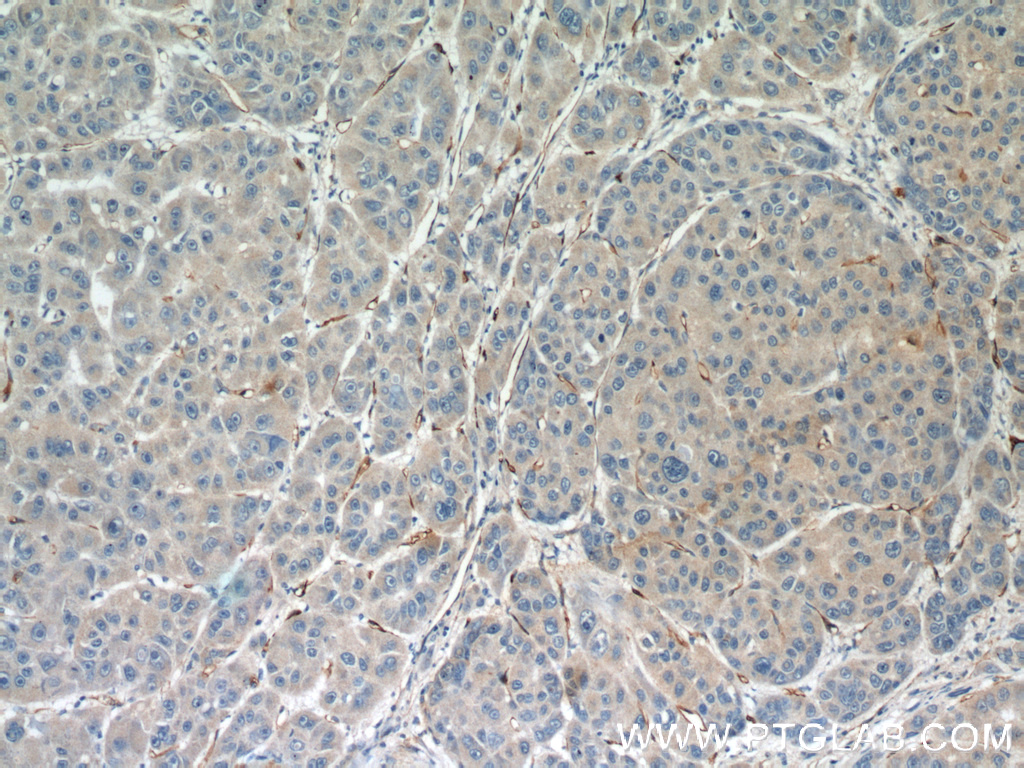 CD34 Antibody 14486-1-AP | Proteintech