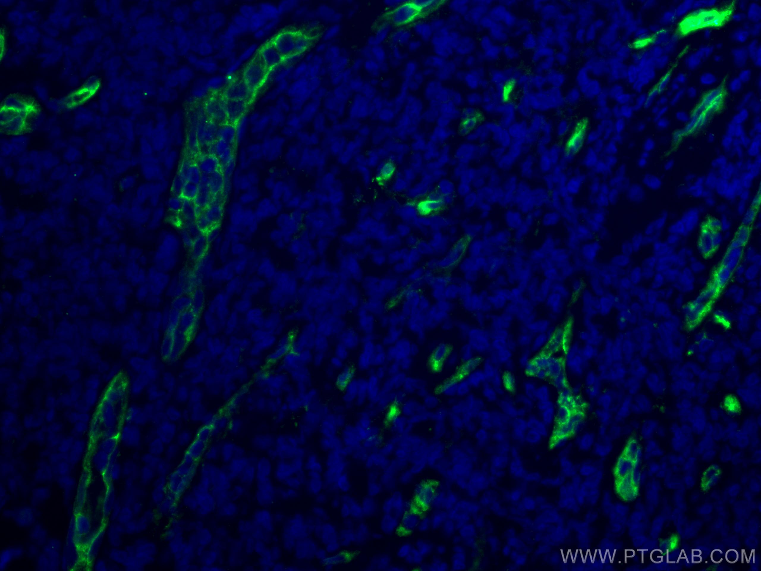 CD34 Antibody 60180-1-Ig | Proteintech
