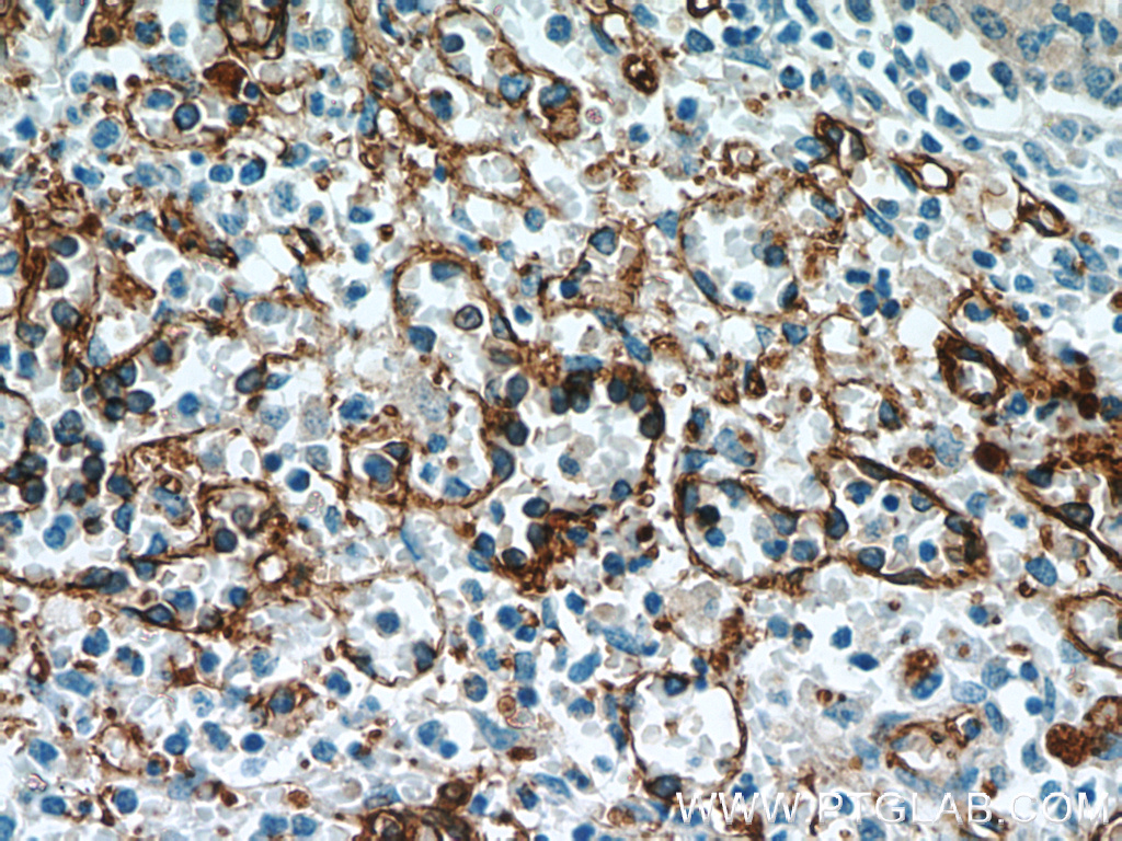 CD36 Antibody 18836-1-AP | Proteintech