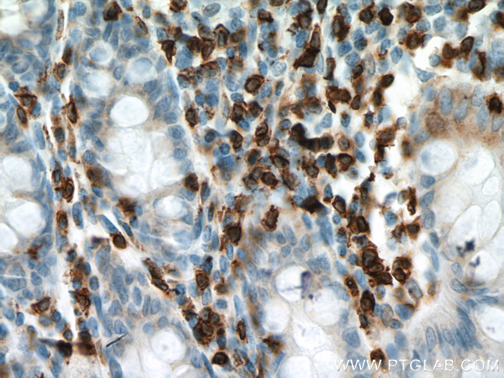 CD3 Antibody 60181-1-Ig | Proteintech