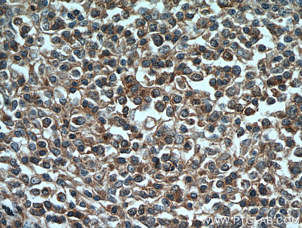 CD3 Gamma Antibody 21120-1-AP | Proteintech