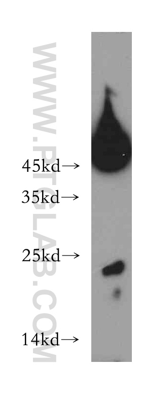 CD3 Gamma Antibody 21120-1-AP | Proteintech