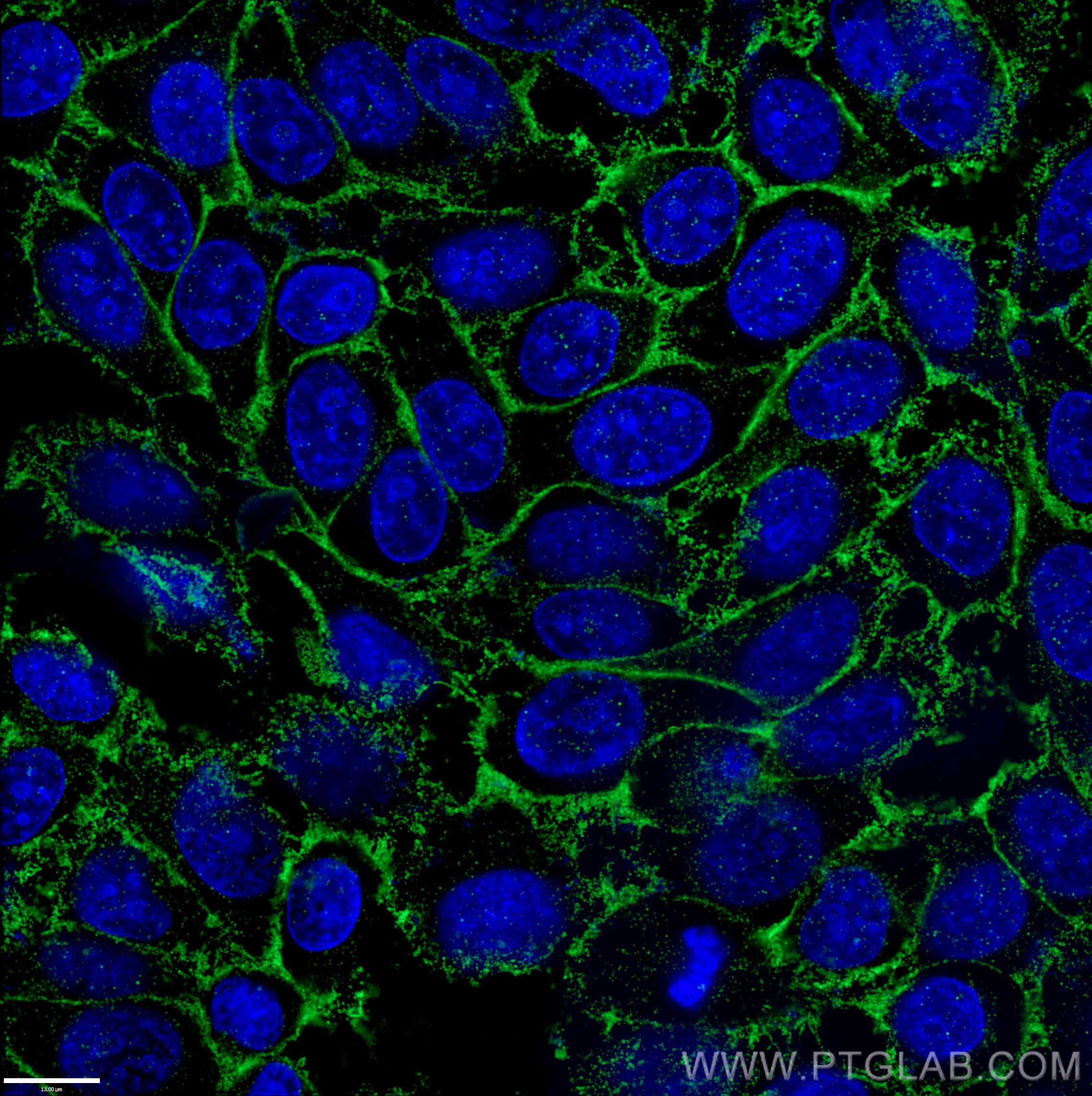 CD44 Antibody 15675-1-AP | Proteintech