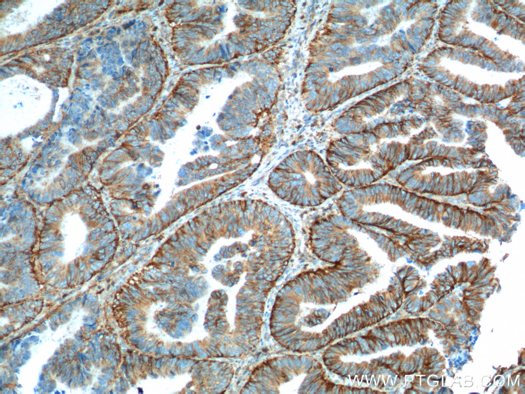 CD44 Antibody 15675-1-AP | Proteintech