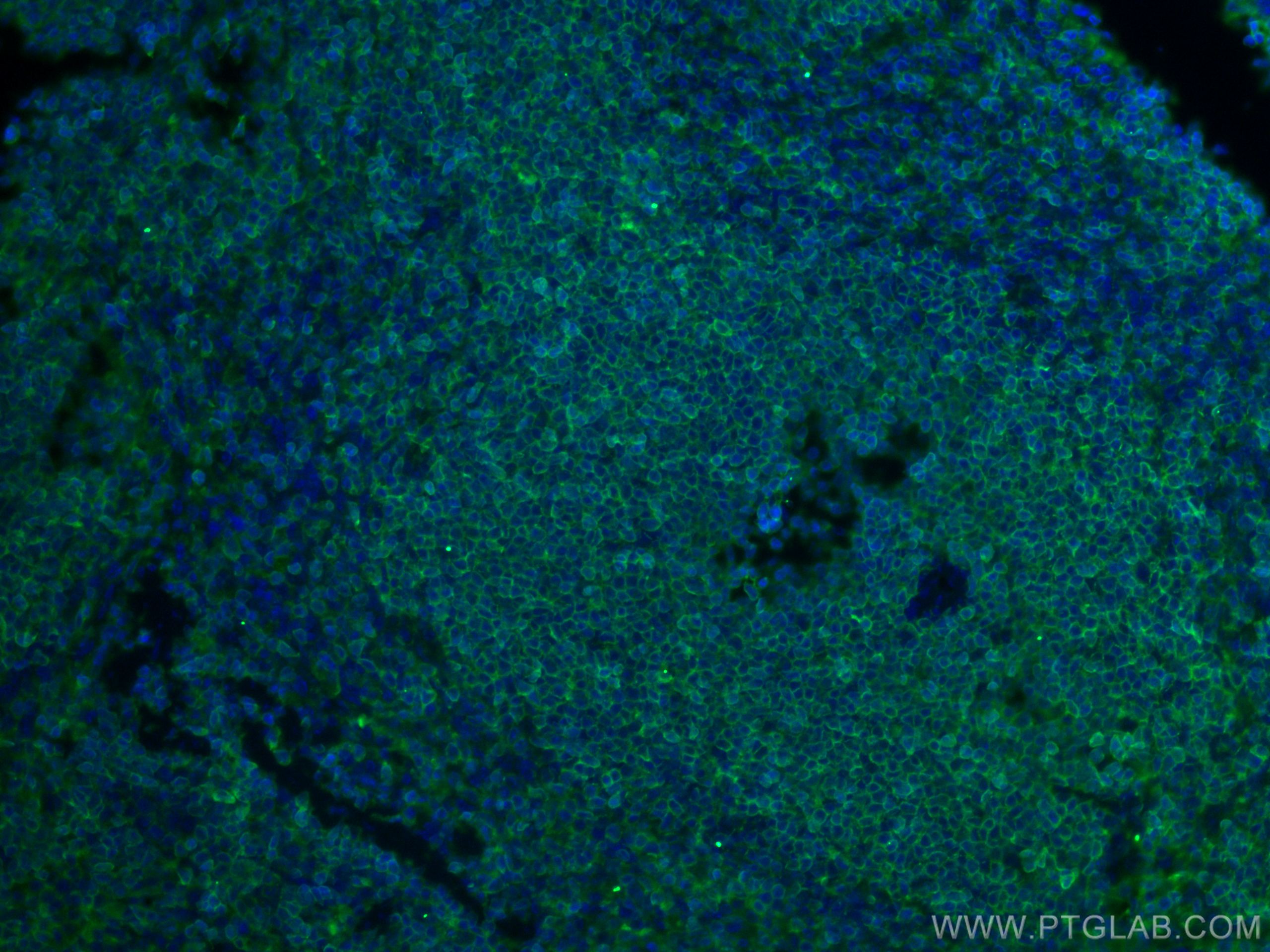 CD45 Antibody 60287-1-Ig | Proteintech