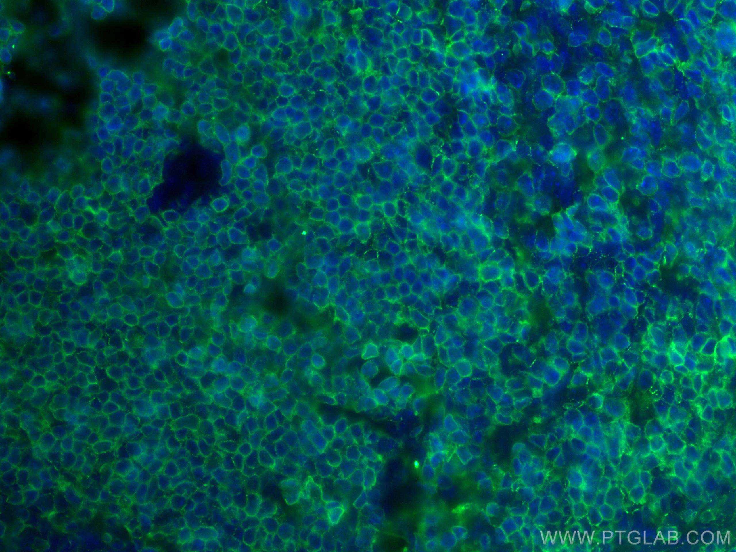 CD45 Antibody 60287-1-Ig | Proteintech