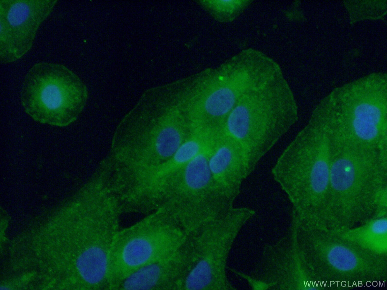 CD55 Antibody 26580-1-AP | Proteintech