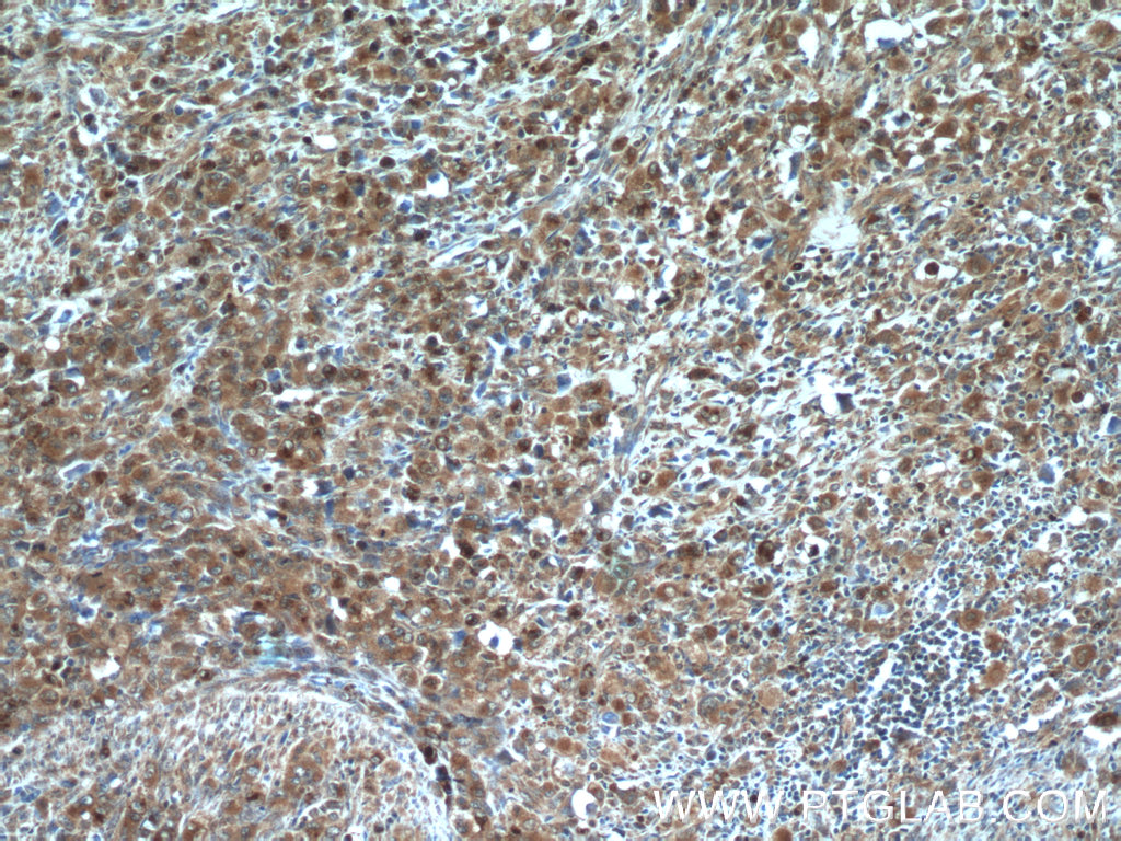 CD63 Antibody 25682-1-AP | Proteintech