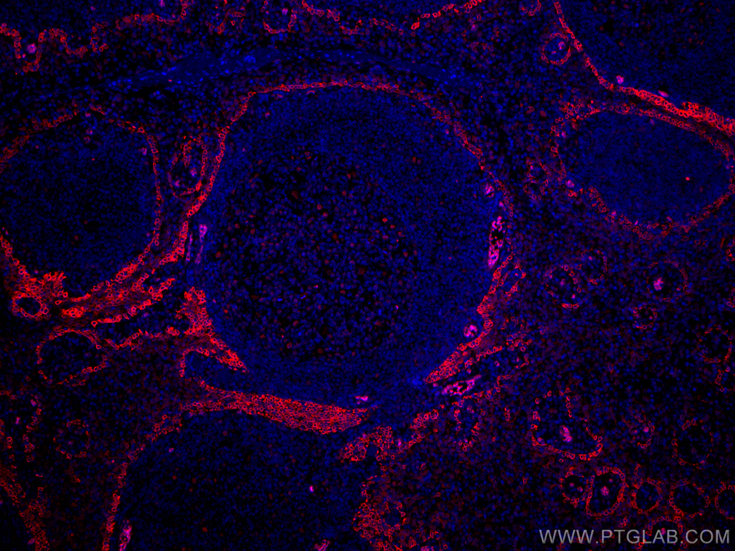 CD63 Antibody CL594-67605 | Proteintech