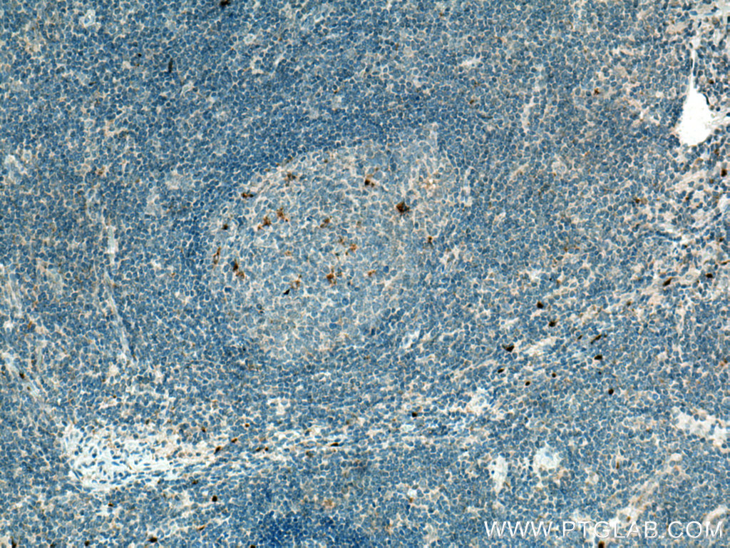 CD68 Antibody 25747-1-AP | Proteintech