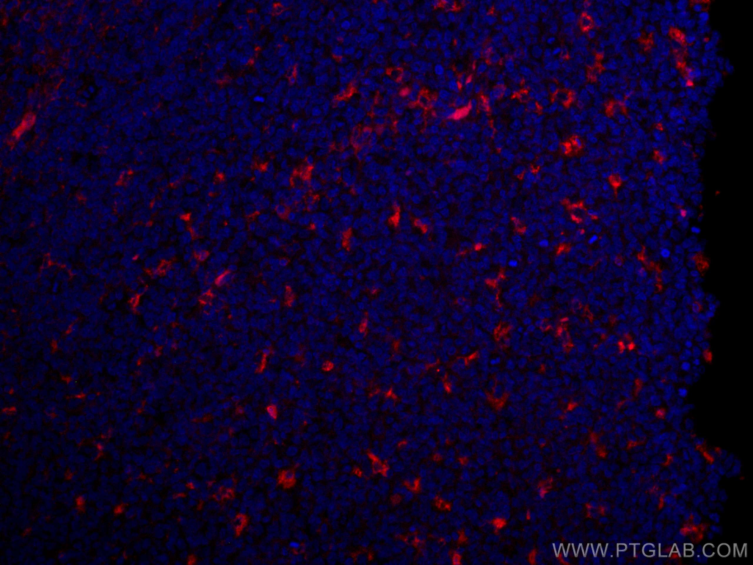 CD68 Antibody CL594-25747 | Proteintech