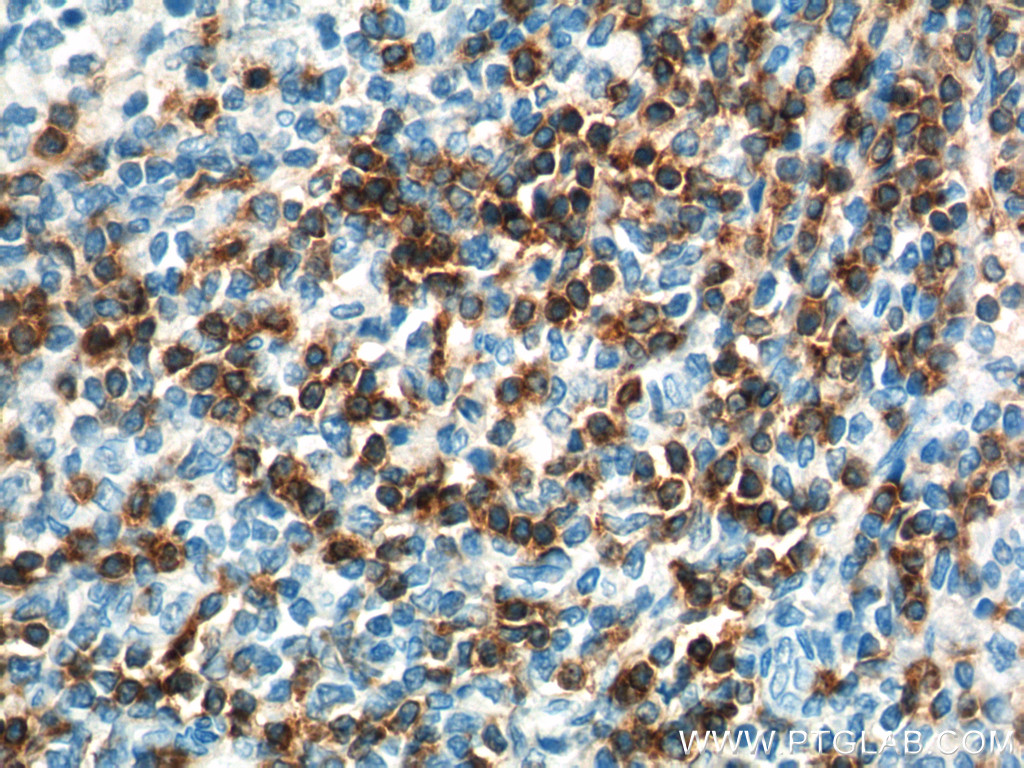 CD7 Antibody 60209-2-Ig | Proteintech