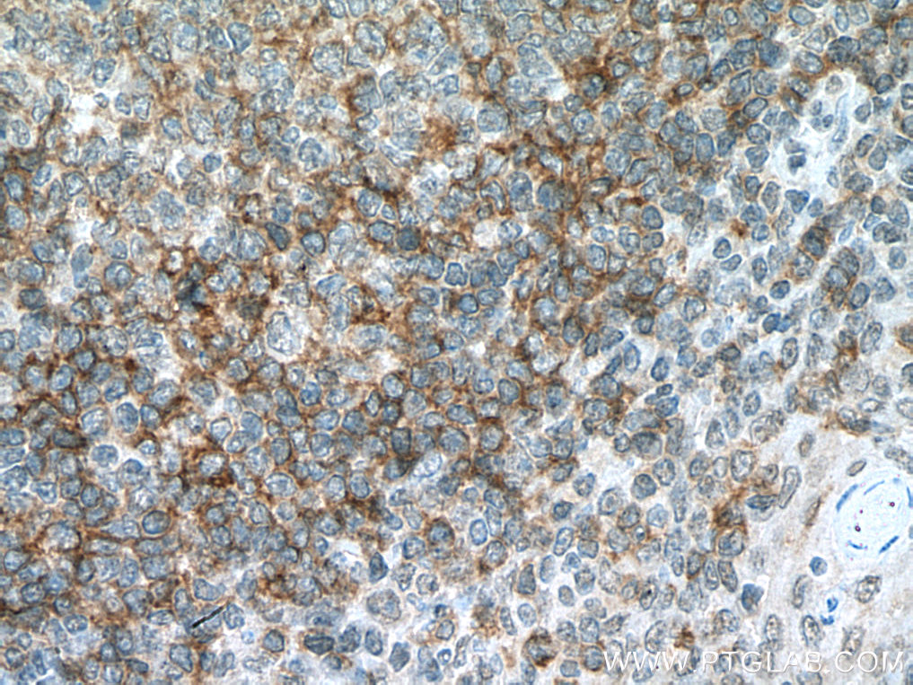 CD72 Antibody 67424-1-Ig | Proteintech