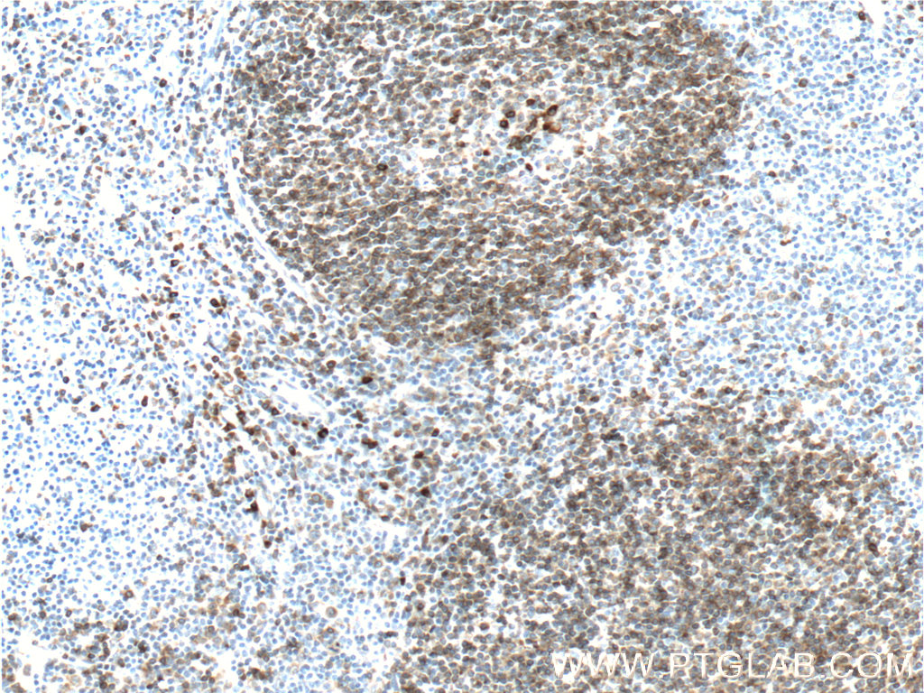 CD79A Antibody 22349-1-AP | Proteintech