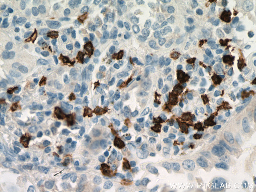 CD8 Antibody 66868-1-Ig | Proteintech