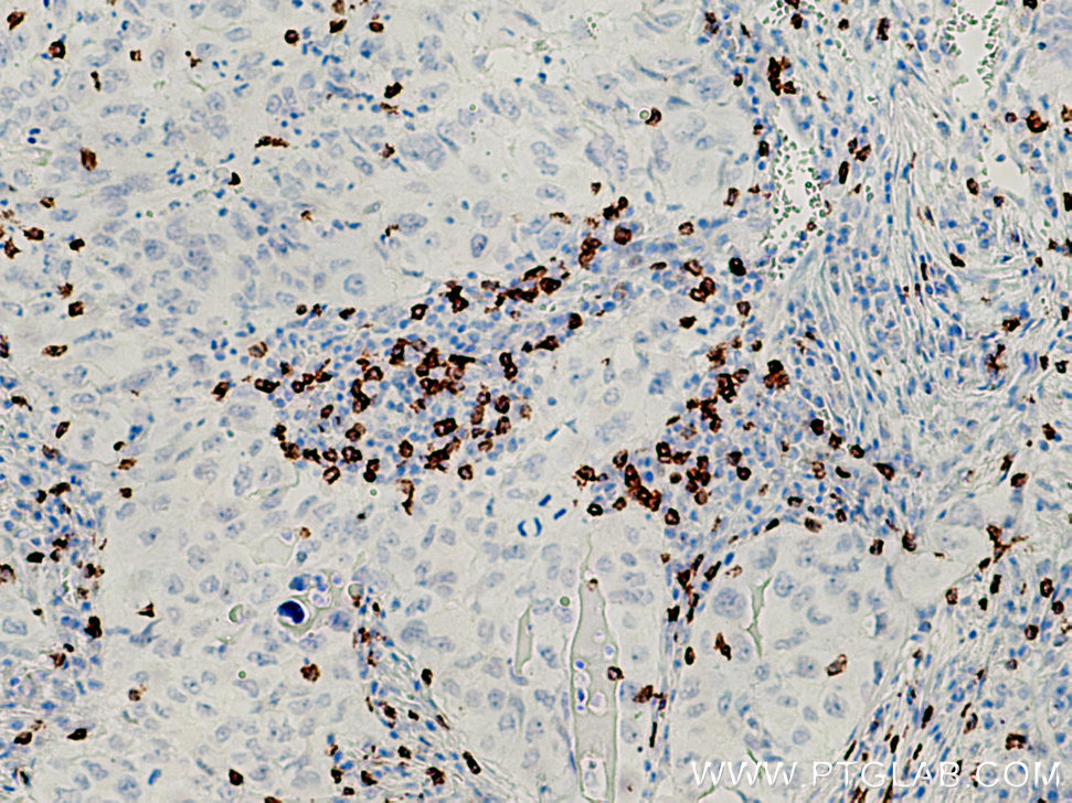 CD8 Antibody 66868-1-Ig | Proteintech