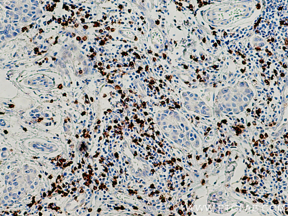 CD8 Antibody 66868-1-Ig | Proteintech