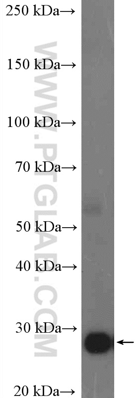 CD9 Antibody 20597-1-AP | Proteintech