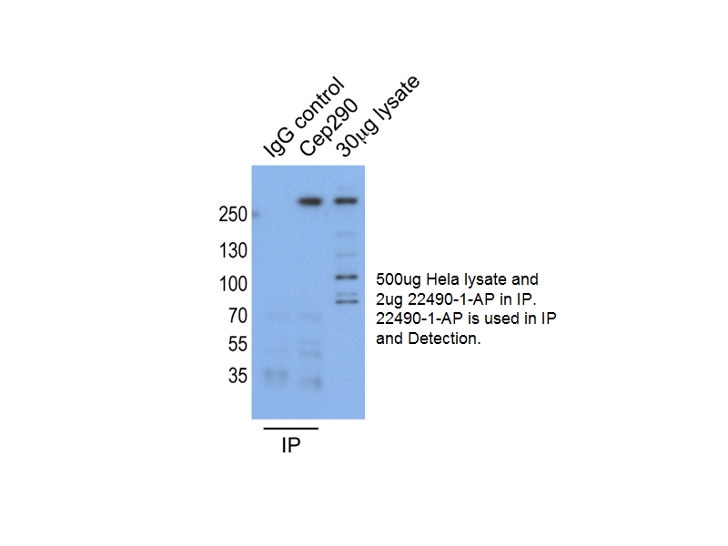 CEP290 Antibody 22490-1-AP | Proteintech