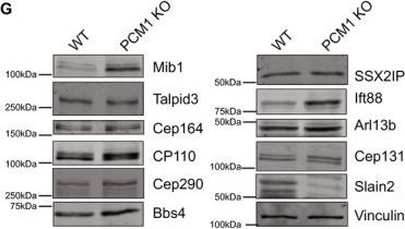 CEP290 Antibody 22490-1-AP | Proteintech