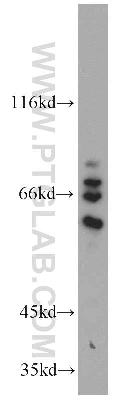 CEP63 Antibody 16268-1-AP | Proteintech