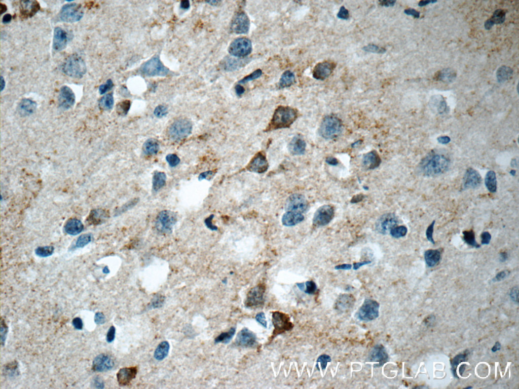 CHAT Antibody 24418-1-AP | Proteintech