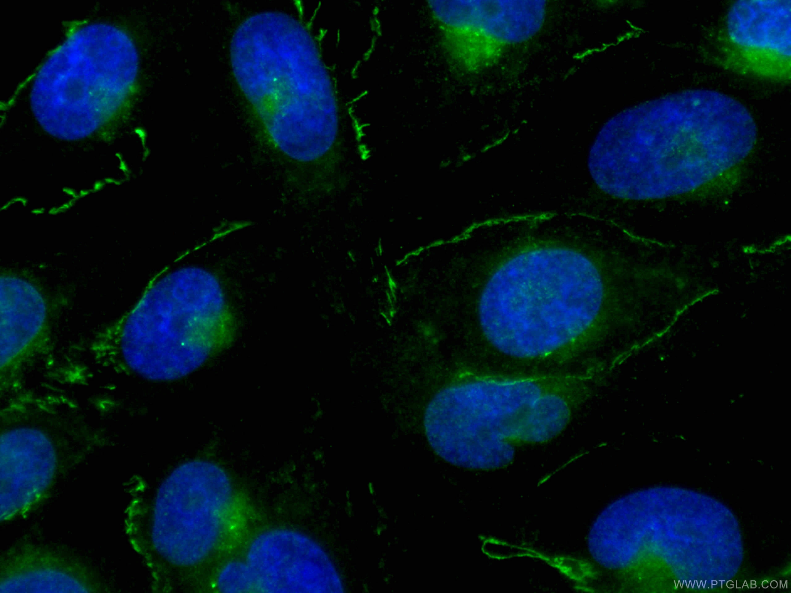 Claudin 1 Antibody 13050-1-AP | Proteintech