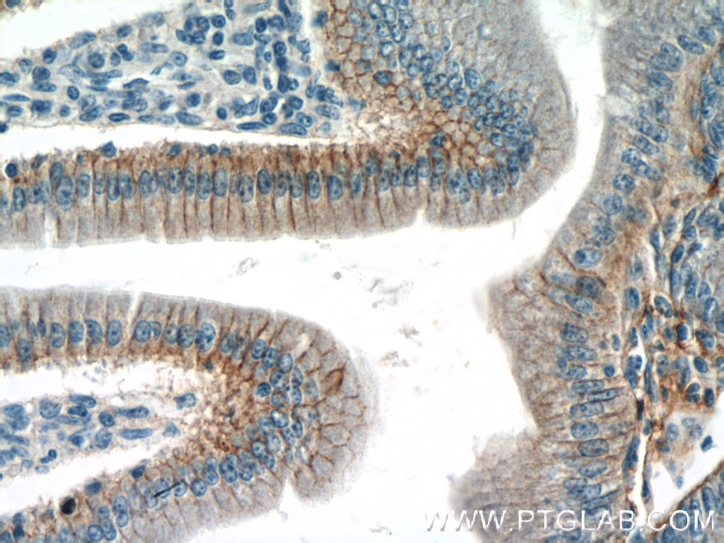Claudin 1 Antibody 13050-1-AP | Proteintech