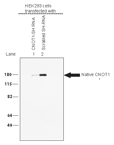 CNOT1 Antibody 14276-1-AP | Proteintech
