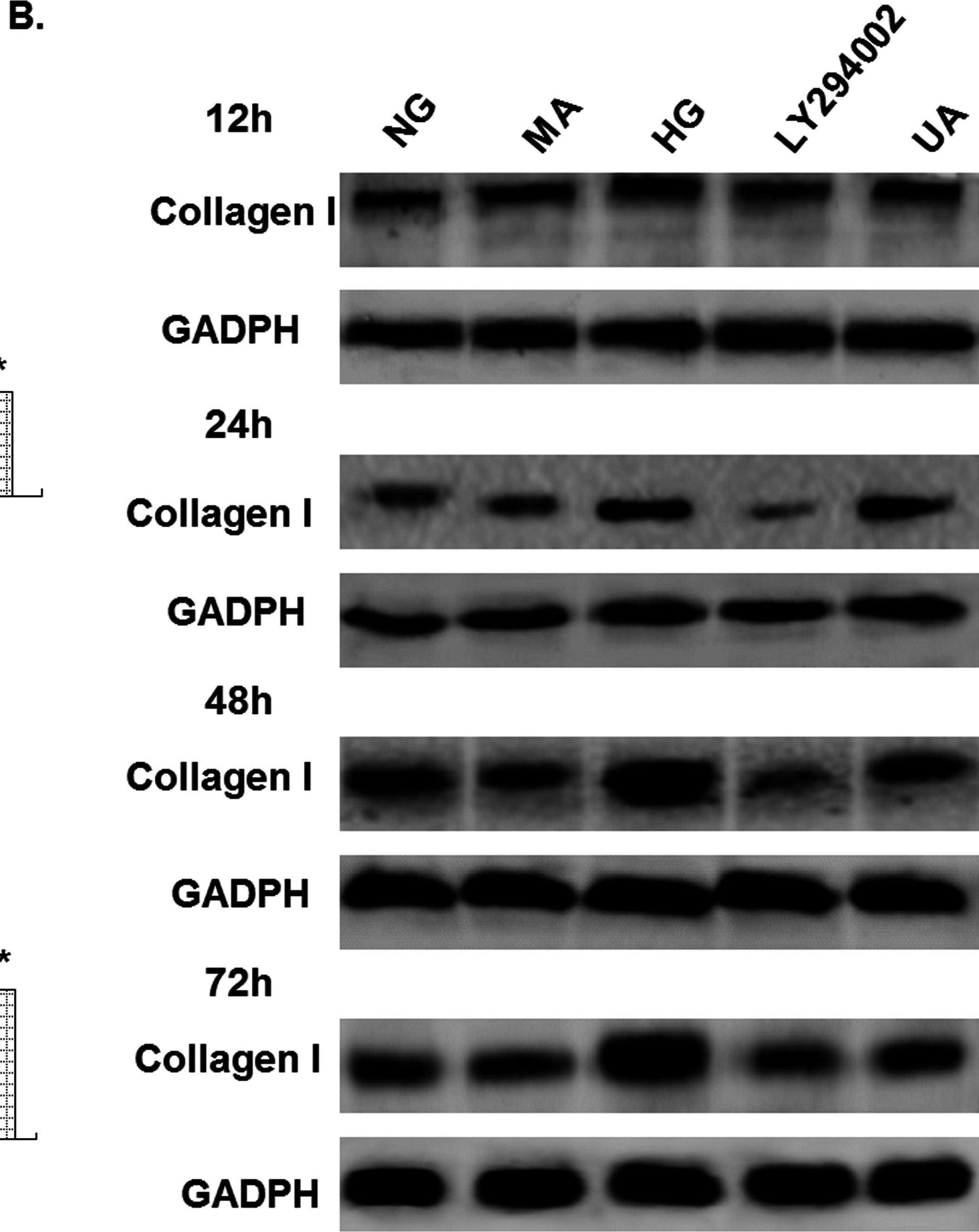 Collagen Type I Antibody 14695-1-AP | Proteintech