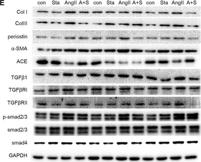Collagen Type I Antibody 14695-1-AP | Proteintech