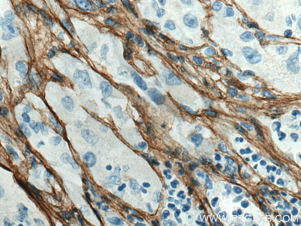 Collagen Type III (N-terminal) Antibody 80009-1-RR | Proteintech