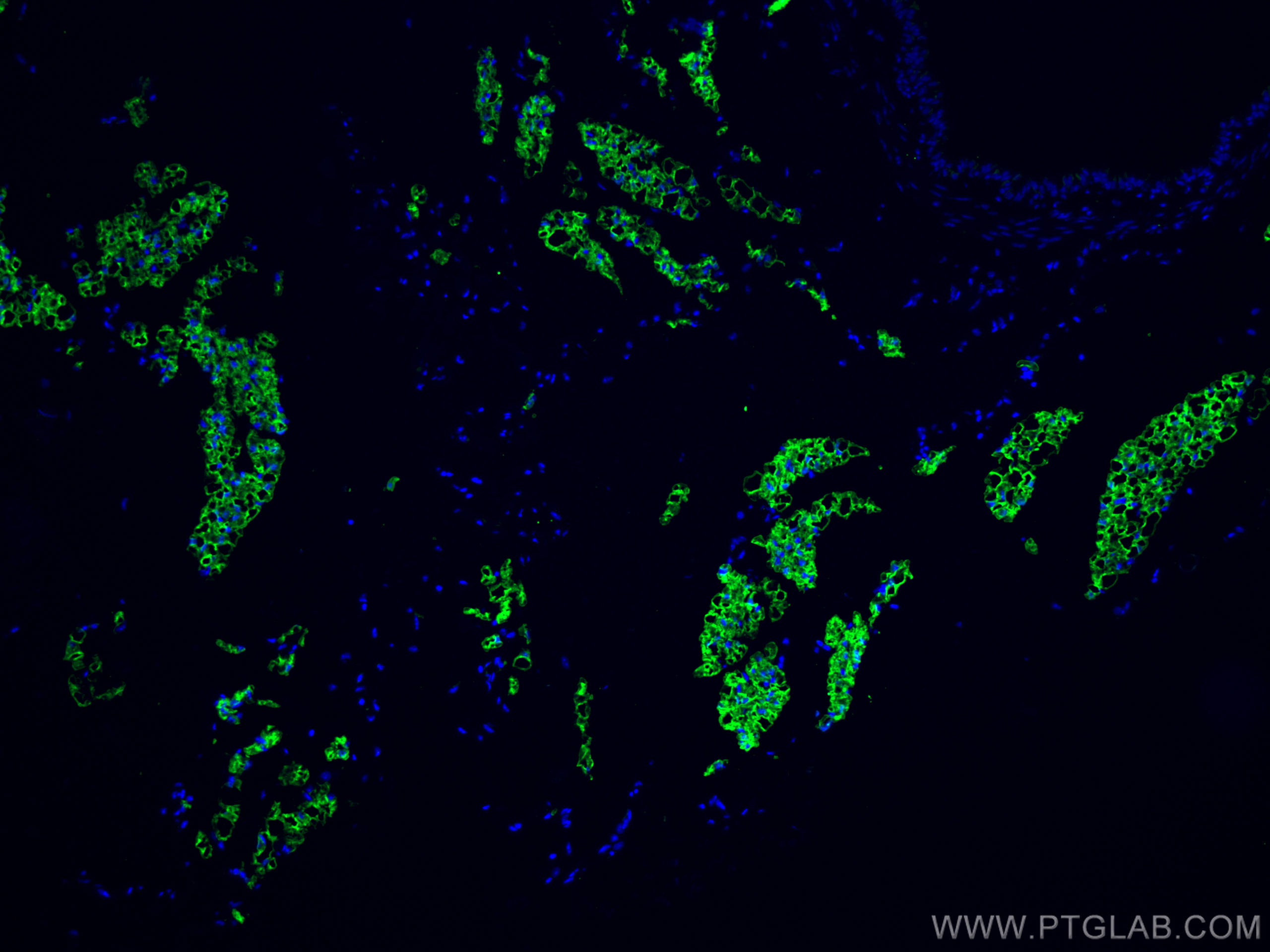 COX2/ Cyclooxygenase 2/ PTGS2 Antibody 66351-1-Ig | Proteintech