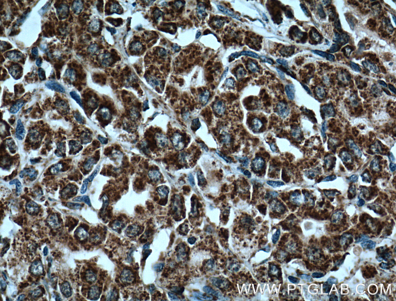 COXIV Antibody 11242-1-AP | Proteintech