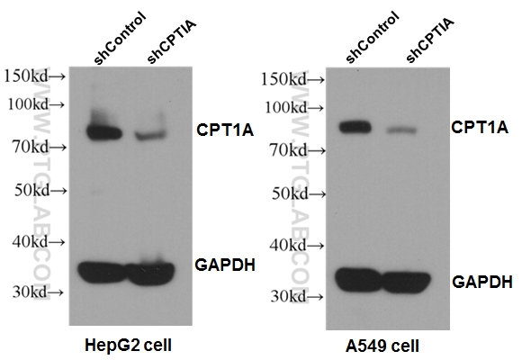 CPT1A Antibody 15184-1-AP | Proteintech