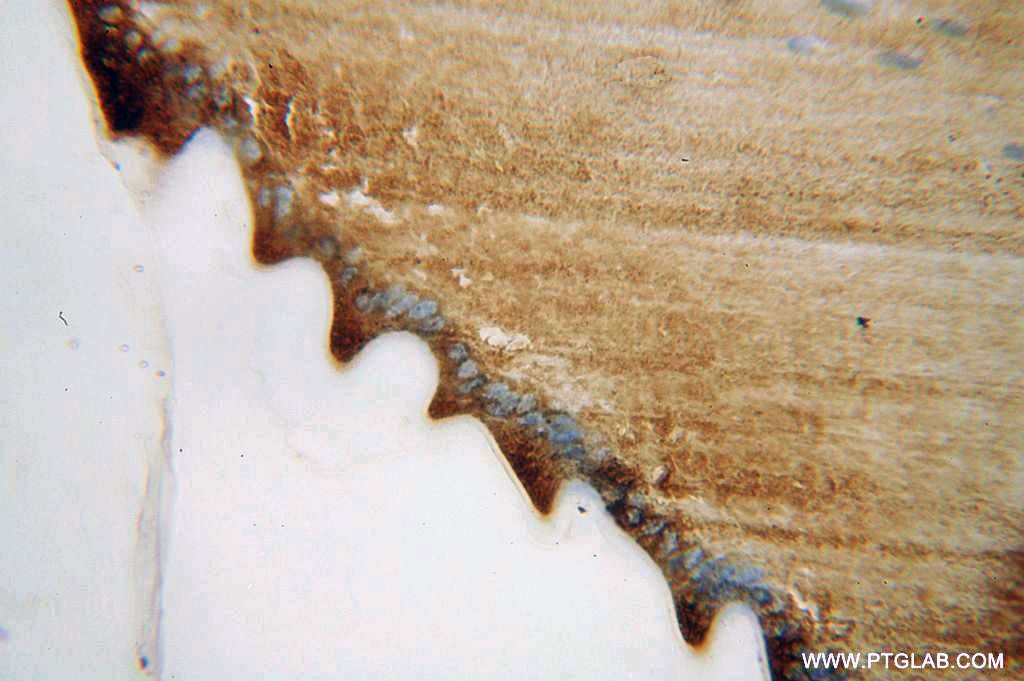 Alpha B Crystallin Antibody 15808-1-AP | Proteintech