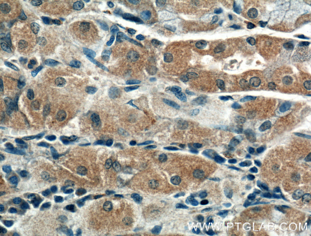 CRYBB3 Antibody 21009-1-AP | Proteintech