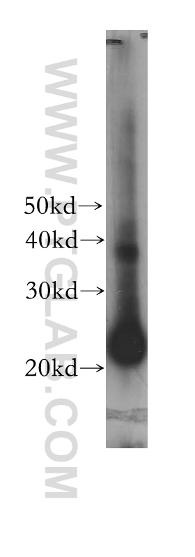 GM-CSF Antibody 17762-1-AP | Proteintech
