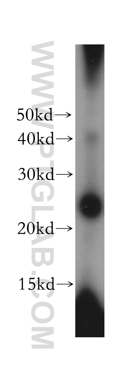 GM-CSF Antibody 17762-1-AP | Proteintech