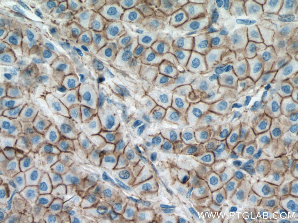 Beta Catenin Antibody 66379-1-Ig | Proteintech