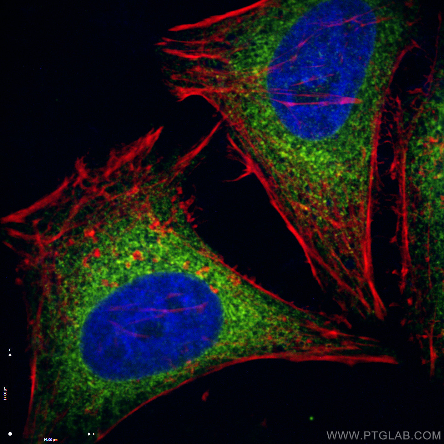 Calreticulin Antibody 27298-1-AP | Proteintech