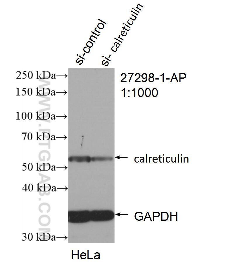 Calreticulin Antibody 27298-1-AP | Proteintech