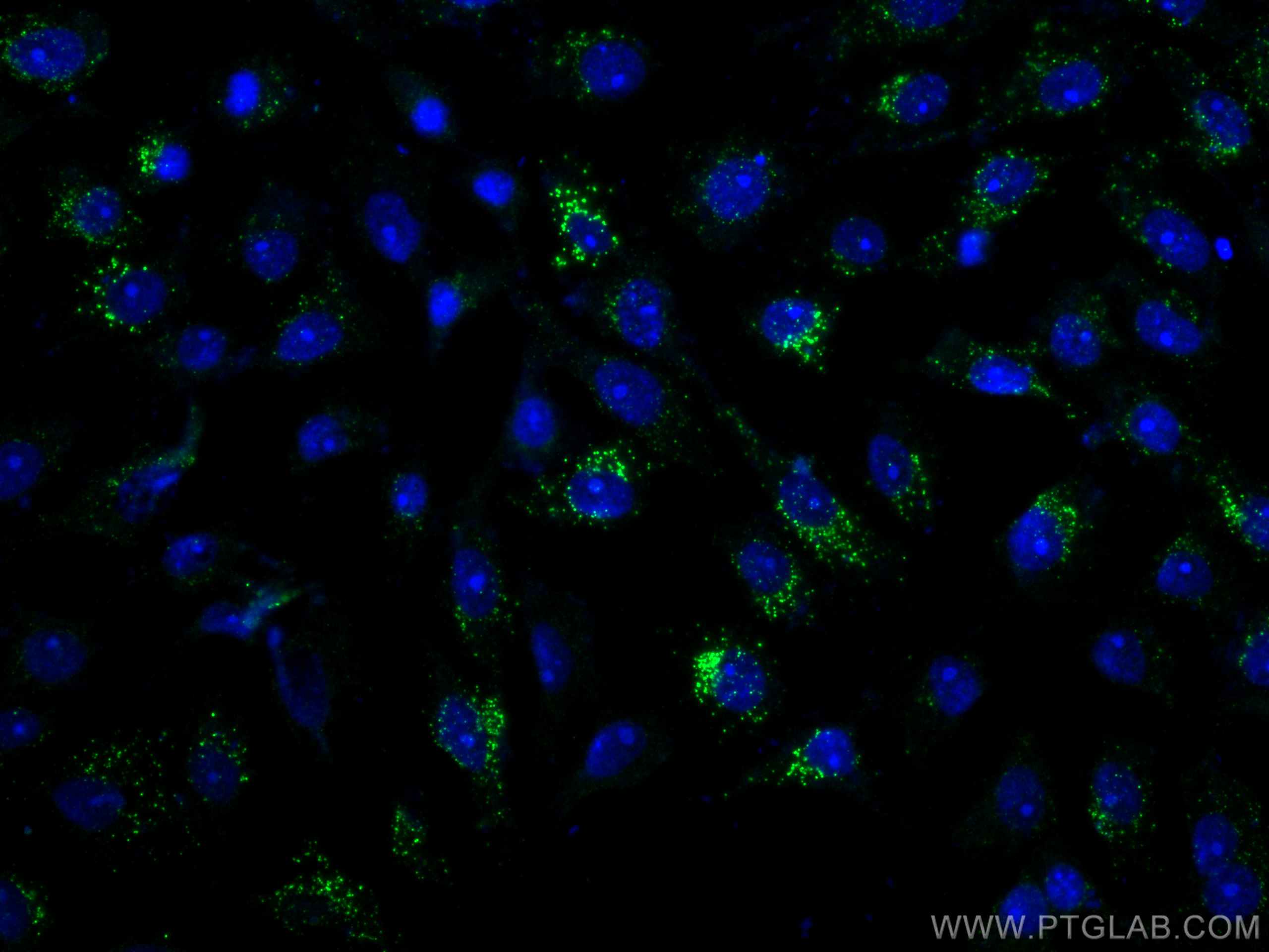 Calretinin Antibody 66496-1-Ig | Proteintech