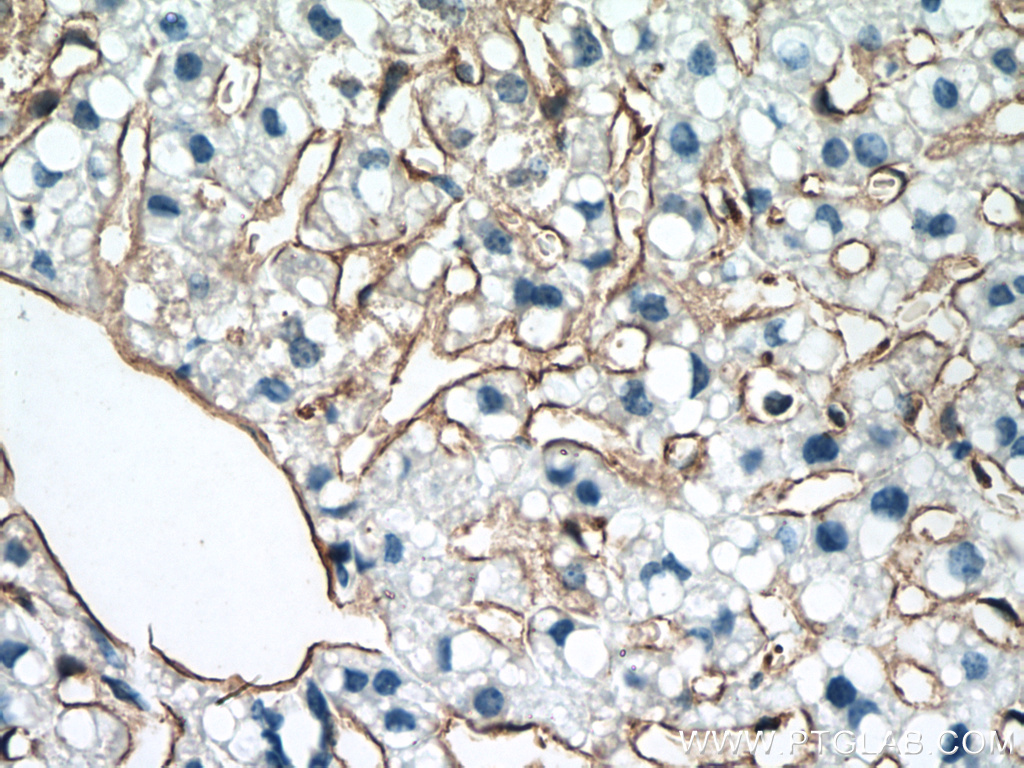 Cd31 Antibody 28083-1-AP | Proteintech