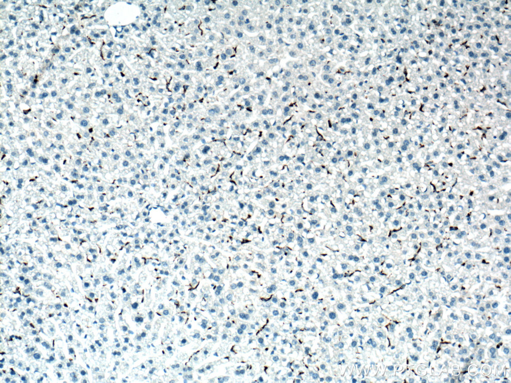 Cd68 Antibody 28058-1-AP | Proteintech