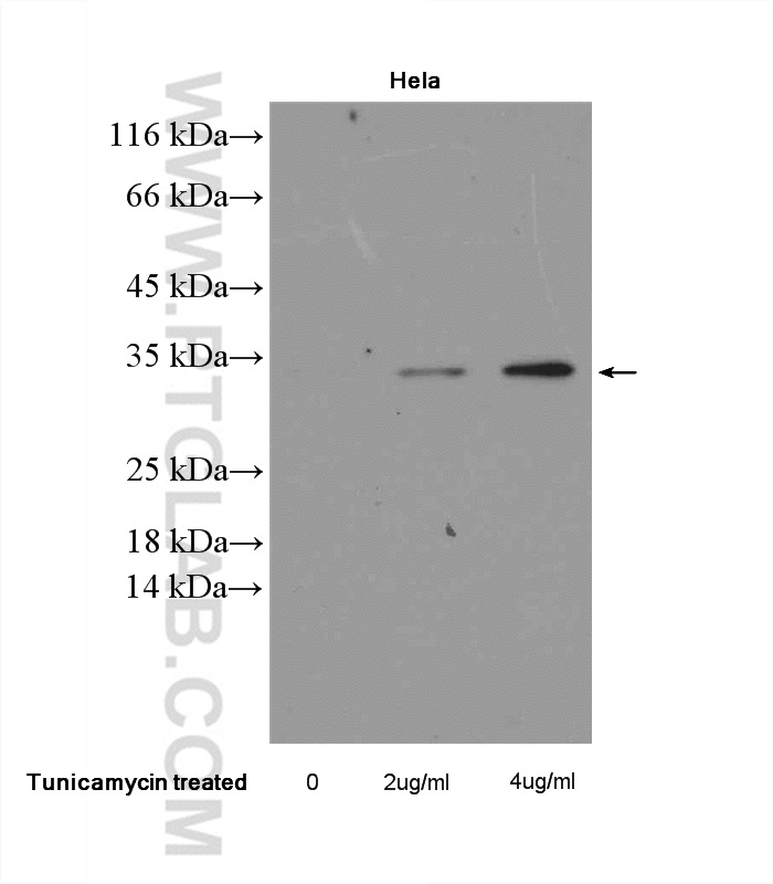 CHOP; GADD153 Antibody 15204-1-AP | Proteintech